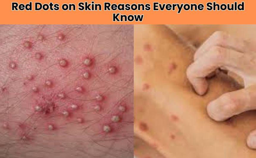Red Dots on Skin Reasons Everyone Should Know - Sweet Love Tips